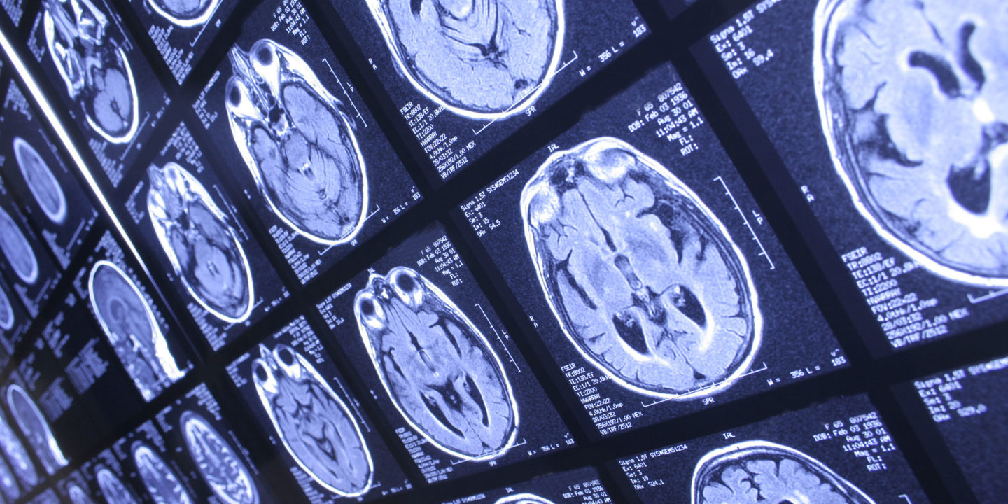 Colloquium: "Functional and structural properties of the visual cortex ...