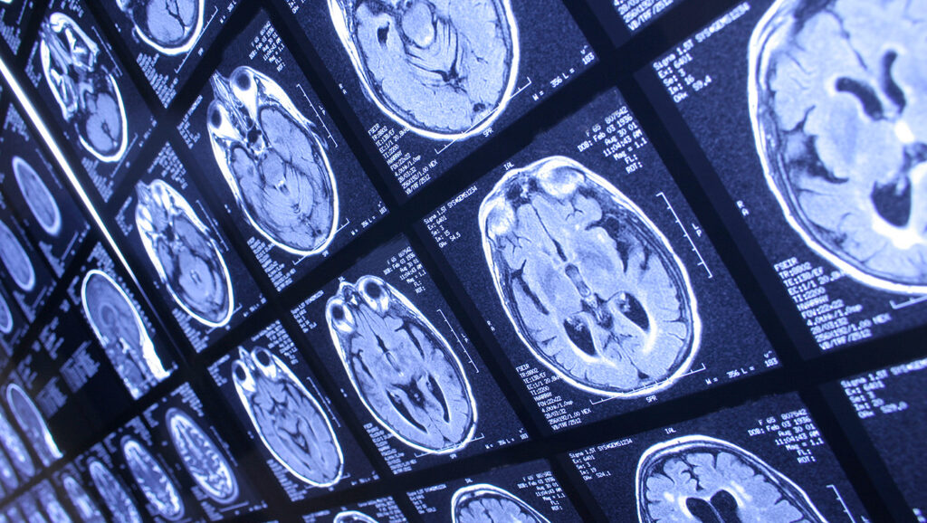 Instagram Takeover: Brain Awareness Week with COS NEURONS ...
